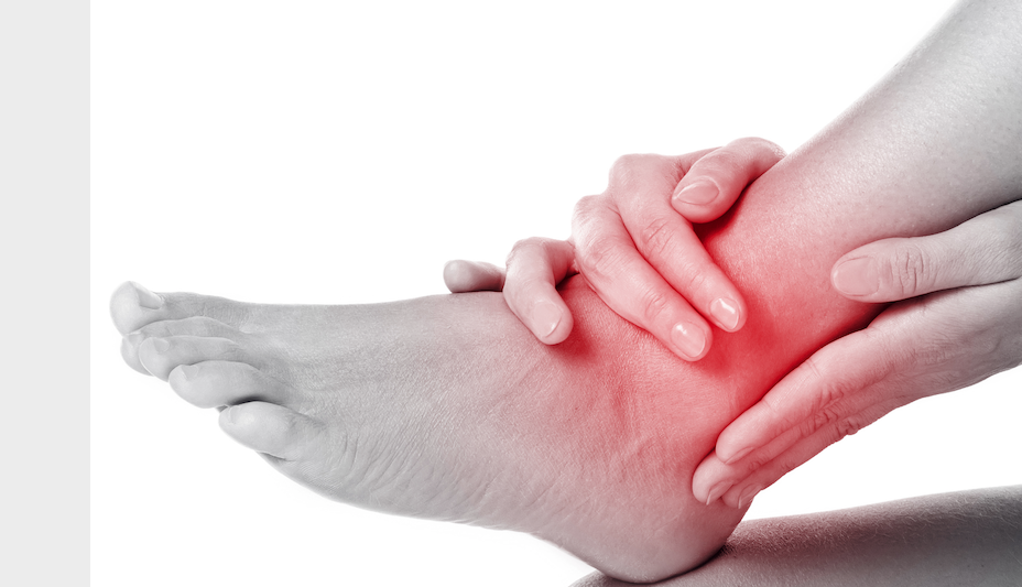 Gout In The Ankle What You Need To Know Newman Feet
